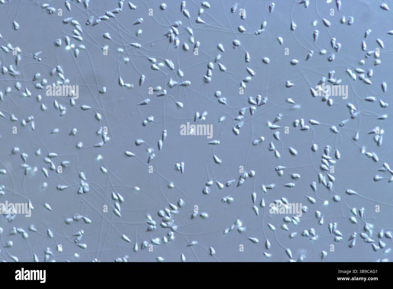 Sea urchin spermatozoa, light micrograph Stock Photo - Alamy