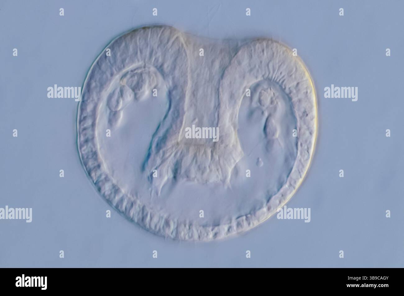 Gastrula stage sea urchin embryo, light micrograph Stock Photo - Alamy