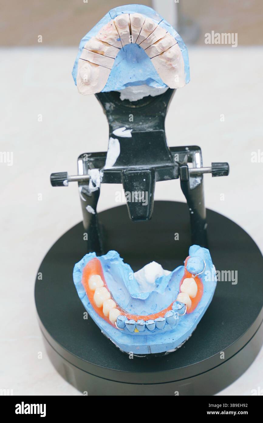 Advanced dental techniques hi-res stock photography and images - Alamy