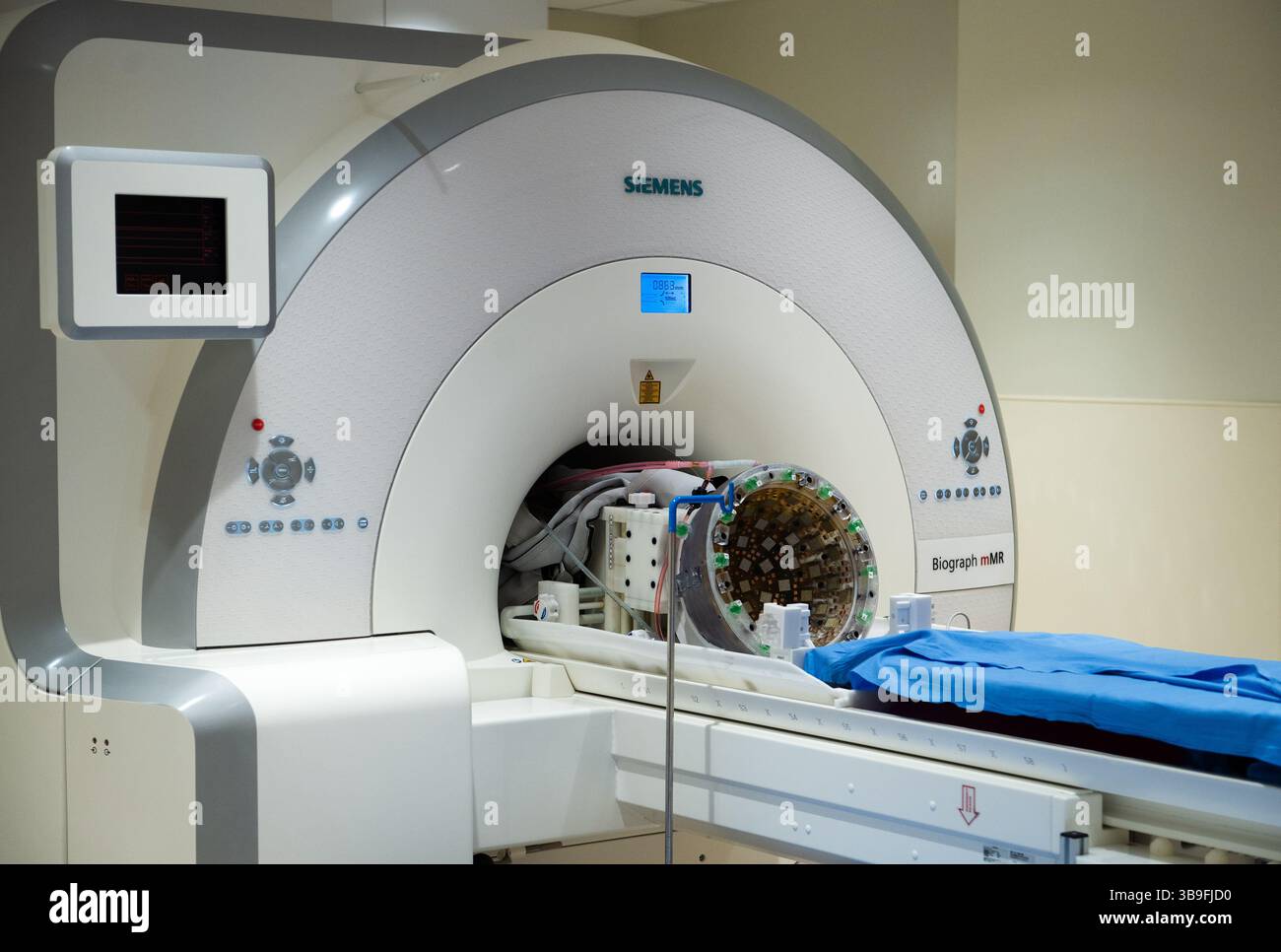 A focused ultrasound helmet is attached to an MRI scanner as part of an ...