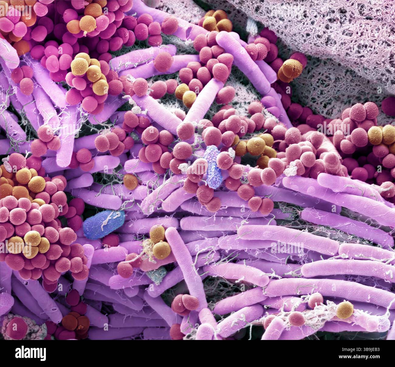 Finger bacteria infection hi-res stock photography and images - Alamy