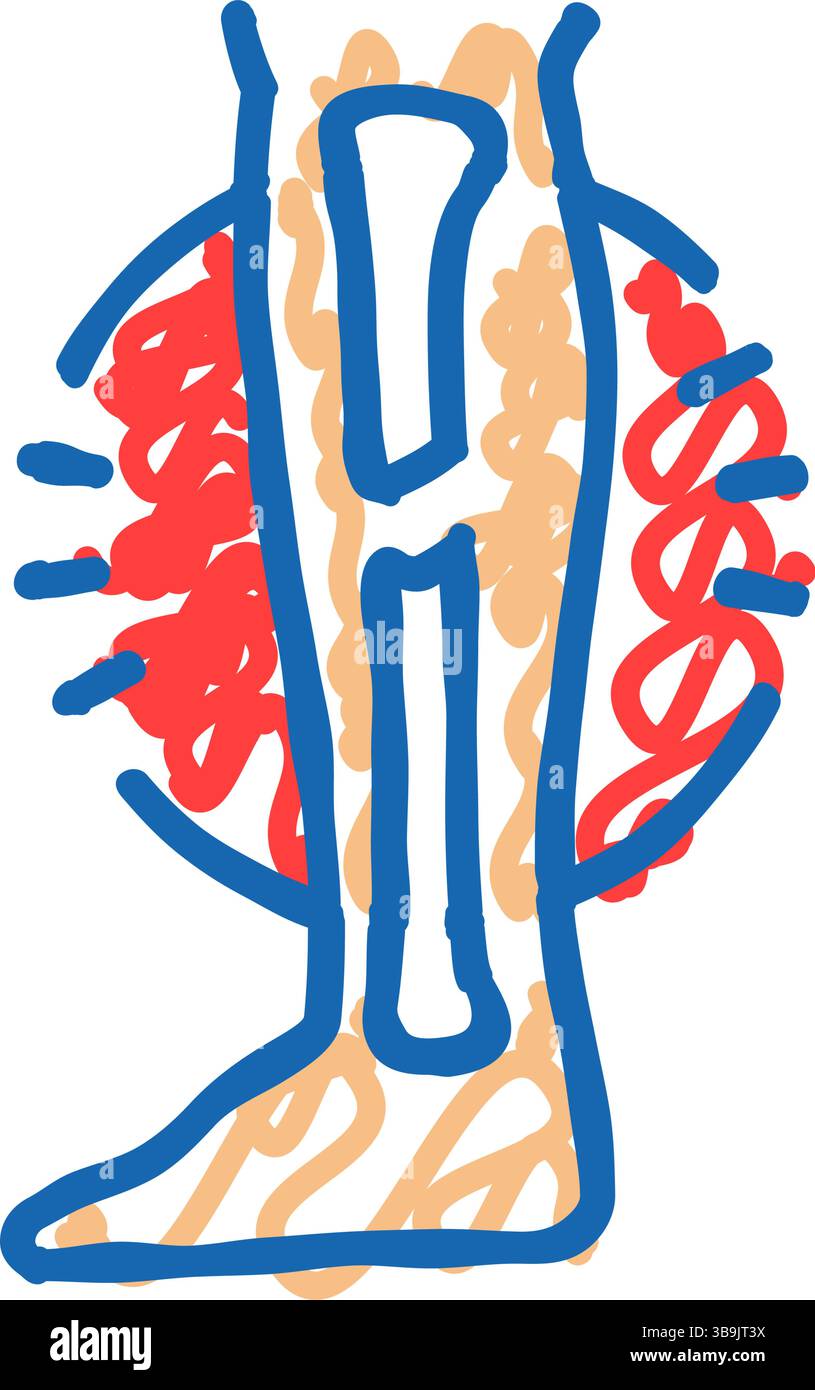 broken leg fracture injury icon doodle illustration Stock Vector Image ...