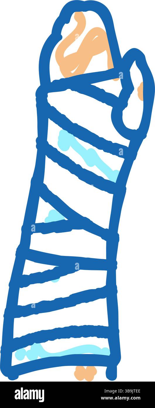 arm cast fracture injury icon doodle illustration Stock Vector Image ...