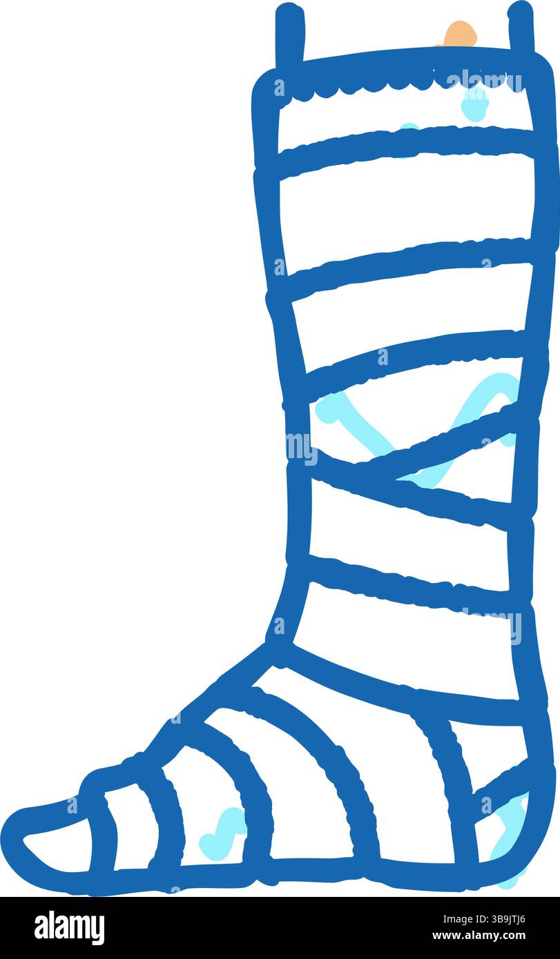 leg cast fracture injury icon doodle illustration Stock Vector Image ...