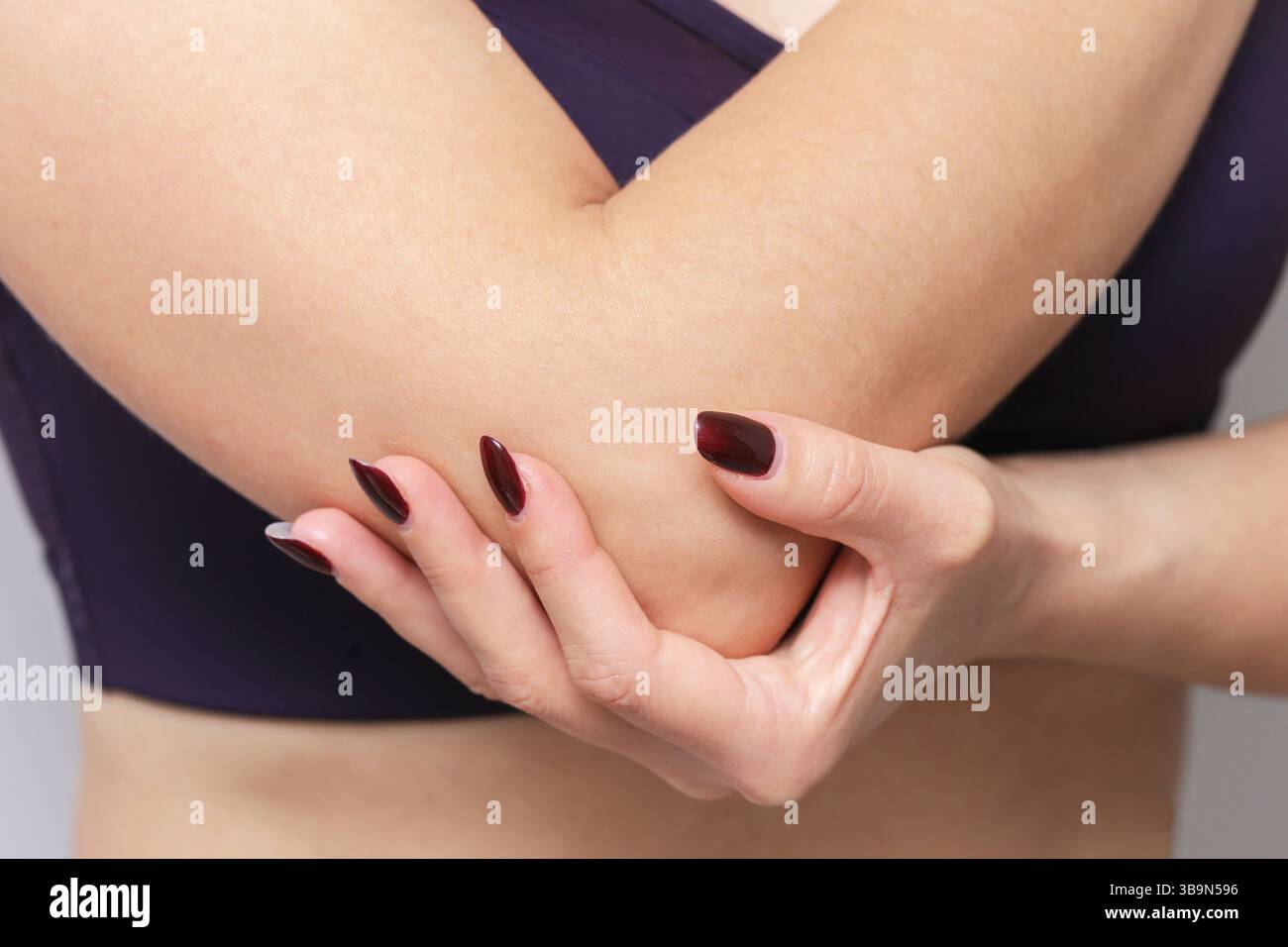 Woman holding her elbow. Painful joint discomfort. Possible ...