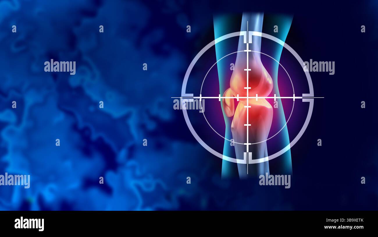 Targeting pain joint hi-res stock photography and images - Alamy