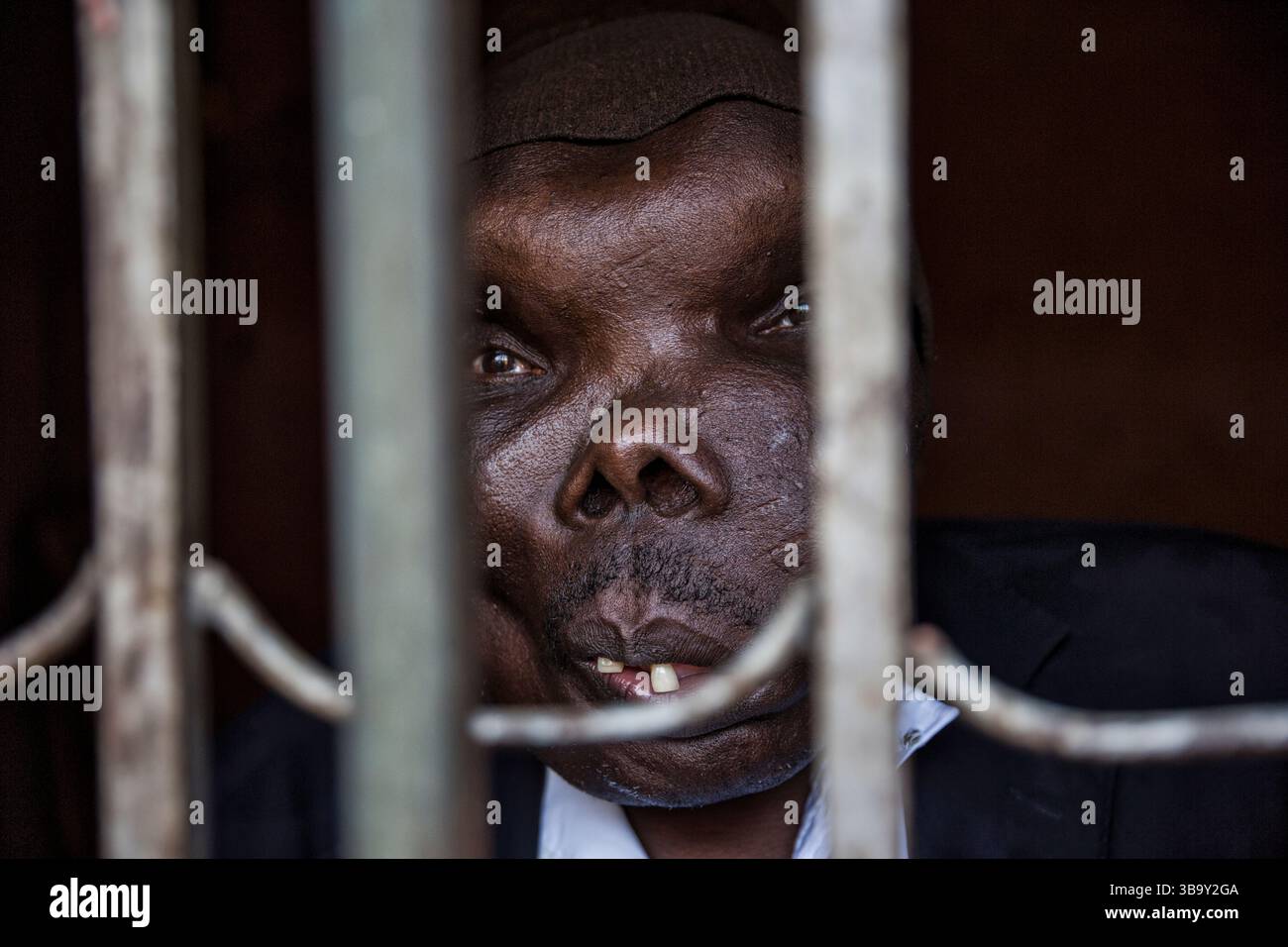 Godfrey Bagume, Sebabi, Fibrodysplasia Ossificans Progressiva (FOP ...