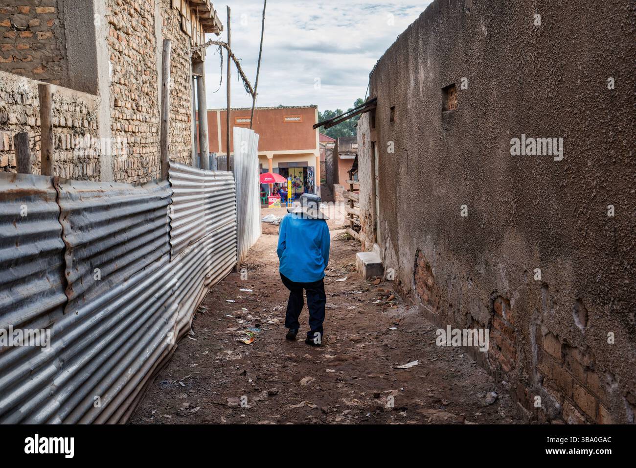 Godfrey Bagume, Sebabi, Fibrodysplasia Ossificans Progressiva (FOP ...