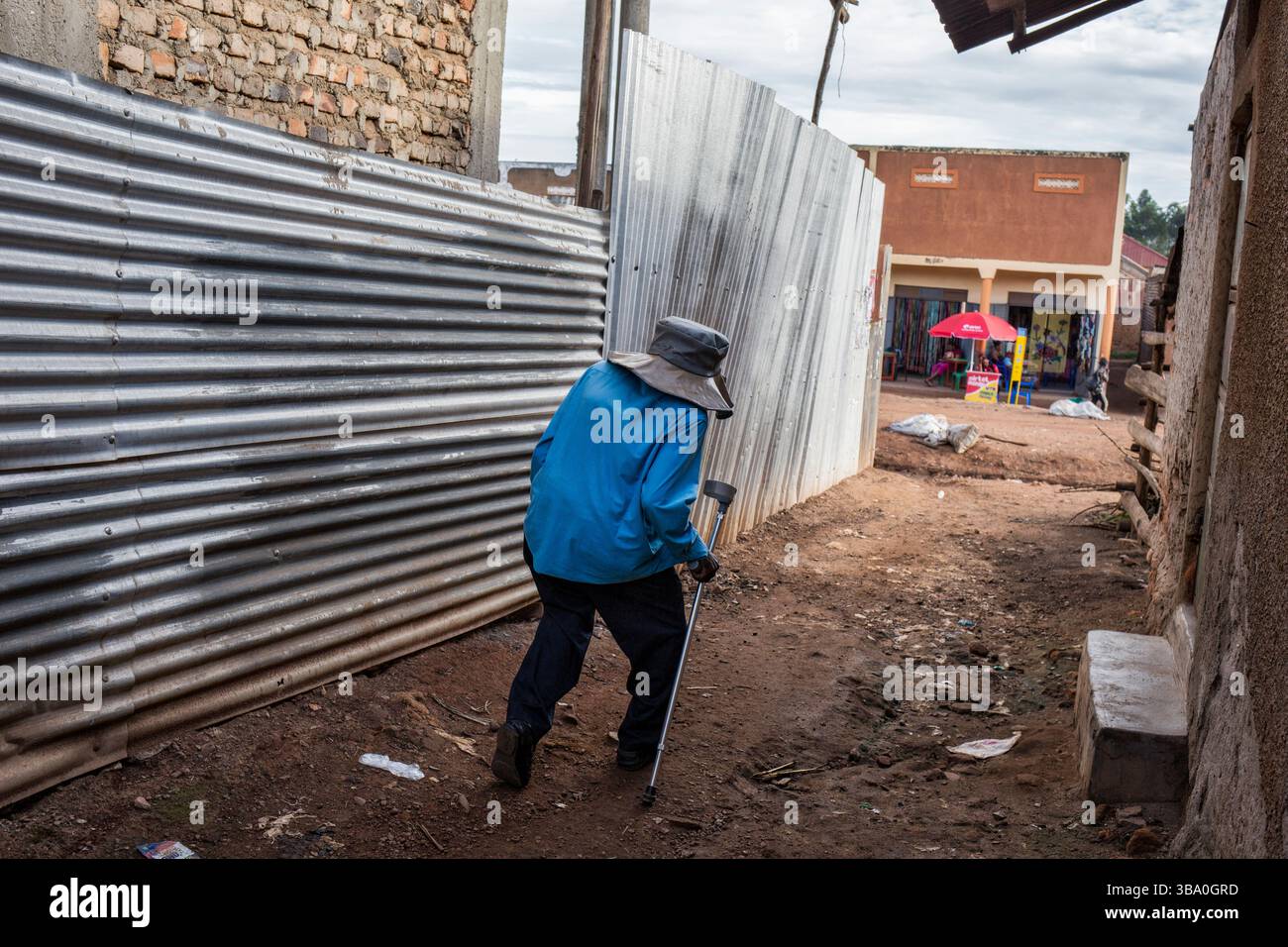 Godfrey Bagume, Sebabi, Fibrodysplasia Ossificans Progressiva (FOP ...