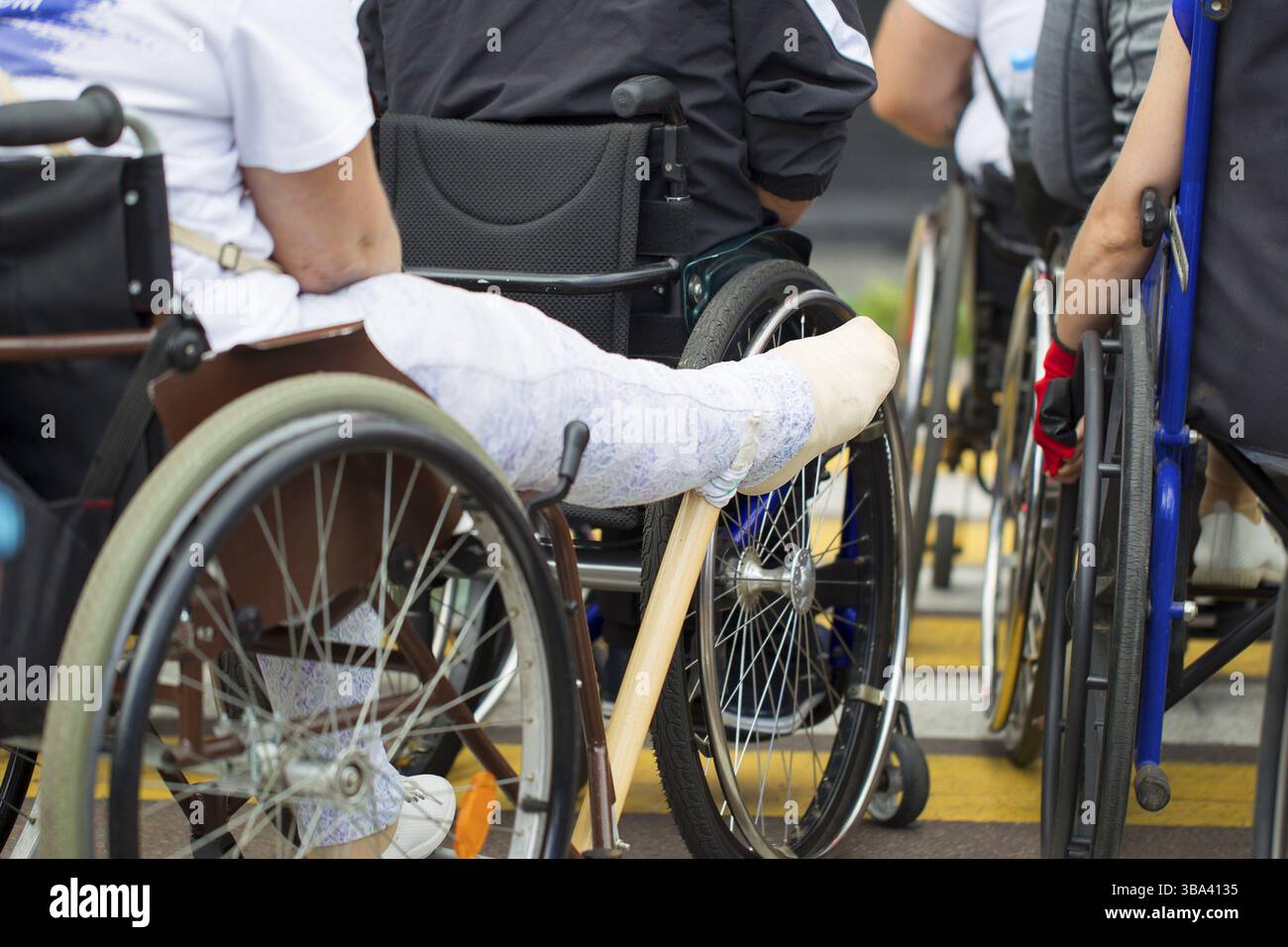 Man with gypsum in a wheelchair Stock Photo - Alamy