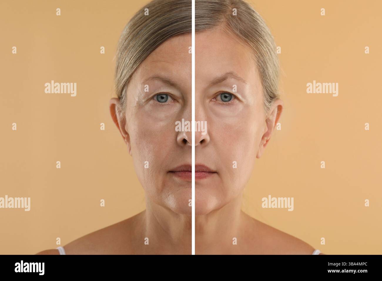 Senior woman showing face before and after collagen consumption on ...