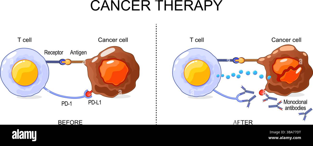 Cancer therapy and Monoclonal antibodies. Vector illustration. Medical ...