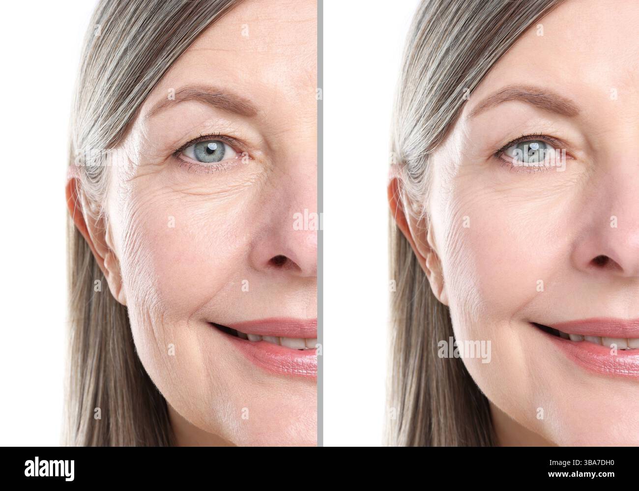 Senior woman showing face before and after collagen consumption on ...