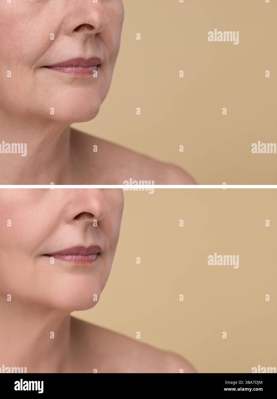 Woman showing face before and after collagen consumption on beige ...