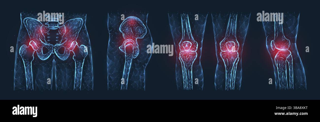 Polygonal vector illustration of pain or inflammation of the bones in ...