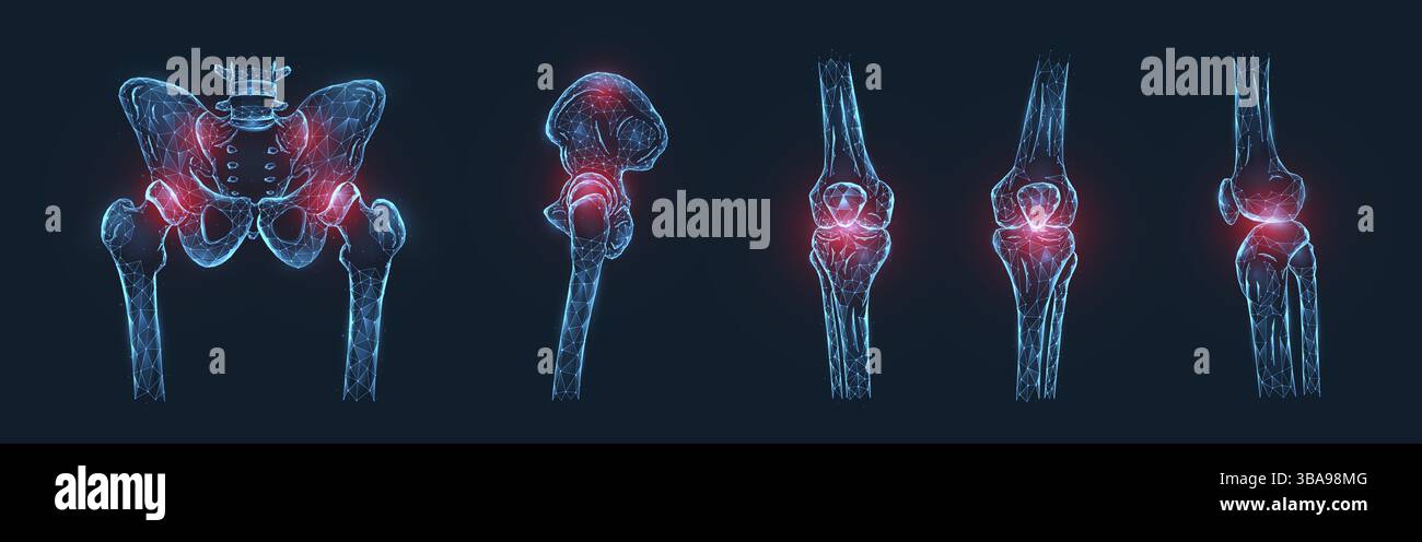 Polygonal vector illustration of pain or inflammation of the bones in ...
