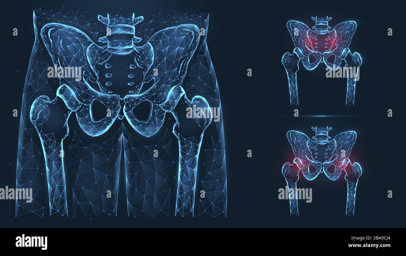 Bones of the pelvis and hip, human anatomy. Pelvic and hip injuries. X ...