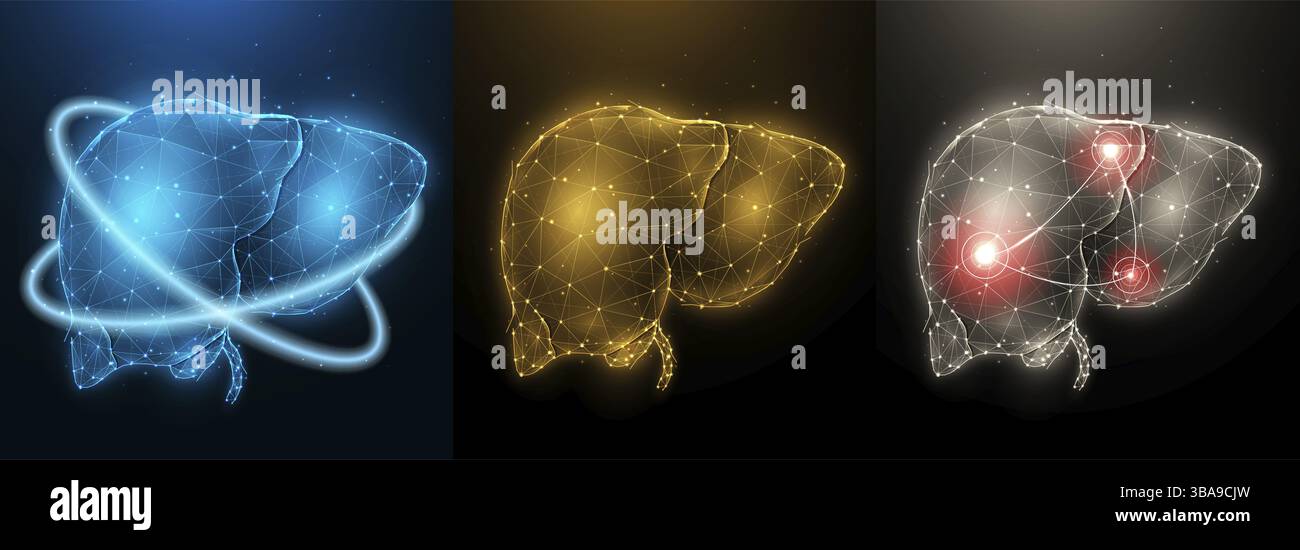 Polygonal vector illustration of inflamed diseased human liver, healthy ...