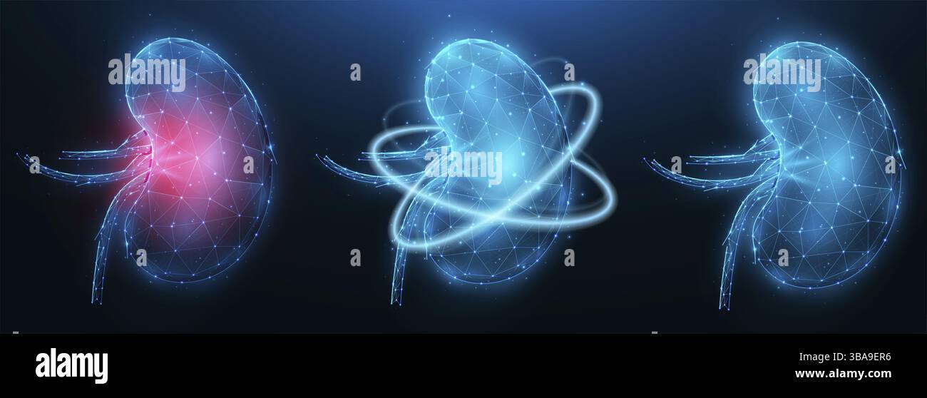 Polygonal vector illustration of inflamed diseased kidney, healthy ...