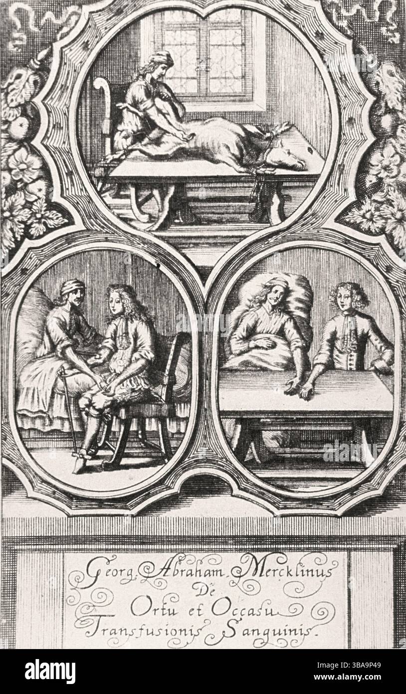Three Examples of Blood Transfusion - Historical engraving Stock Photo ...