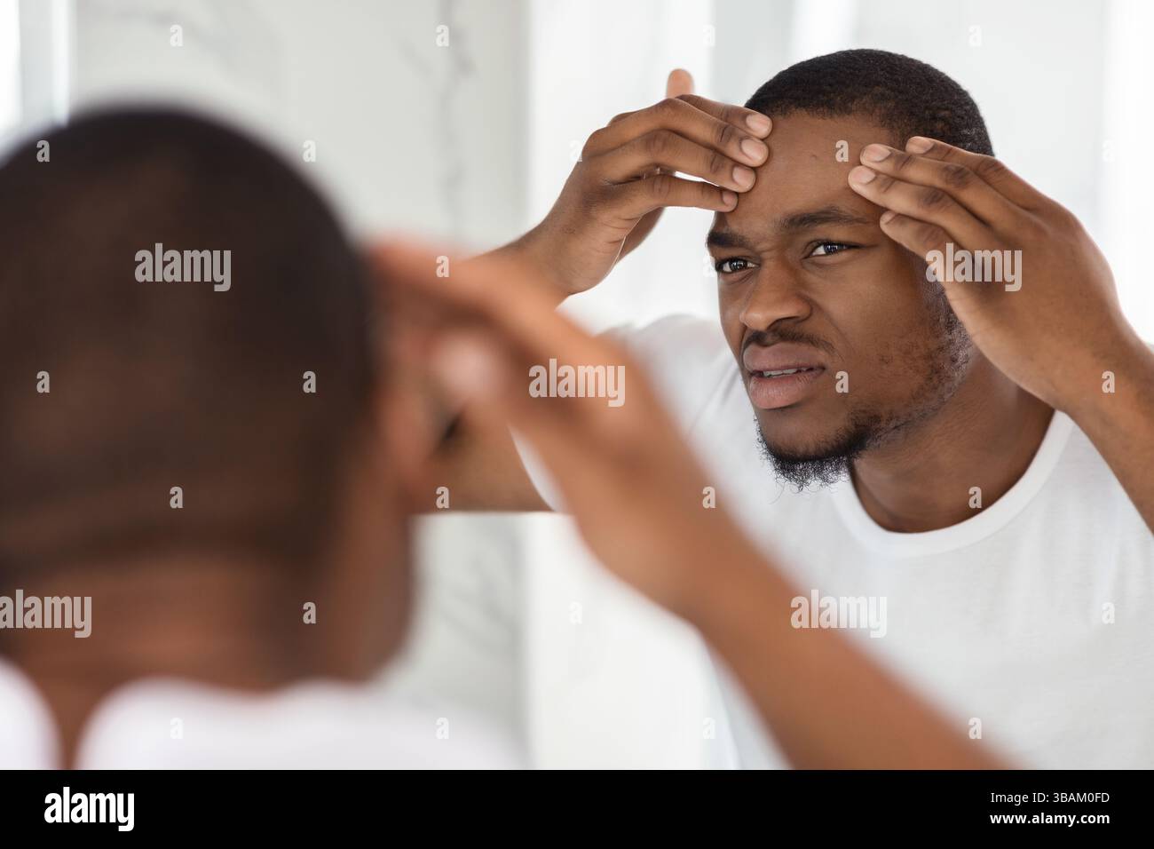 Problem Skin. Concerned Black Guy Inspecting Face, Noticed Pimple On ...