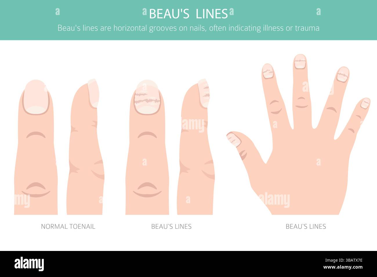 Groove foot Stock Vector Images - Alamy