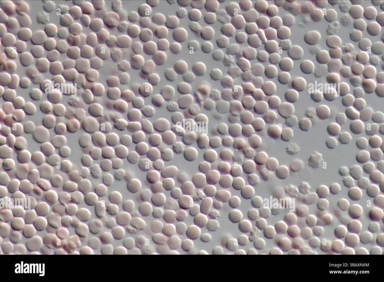 Human red blood cells in hypotonic solution, light micrograph Stock ...