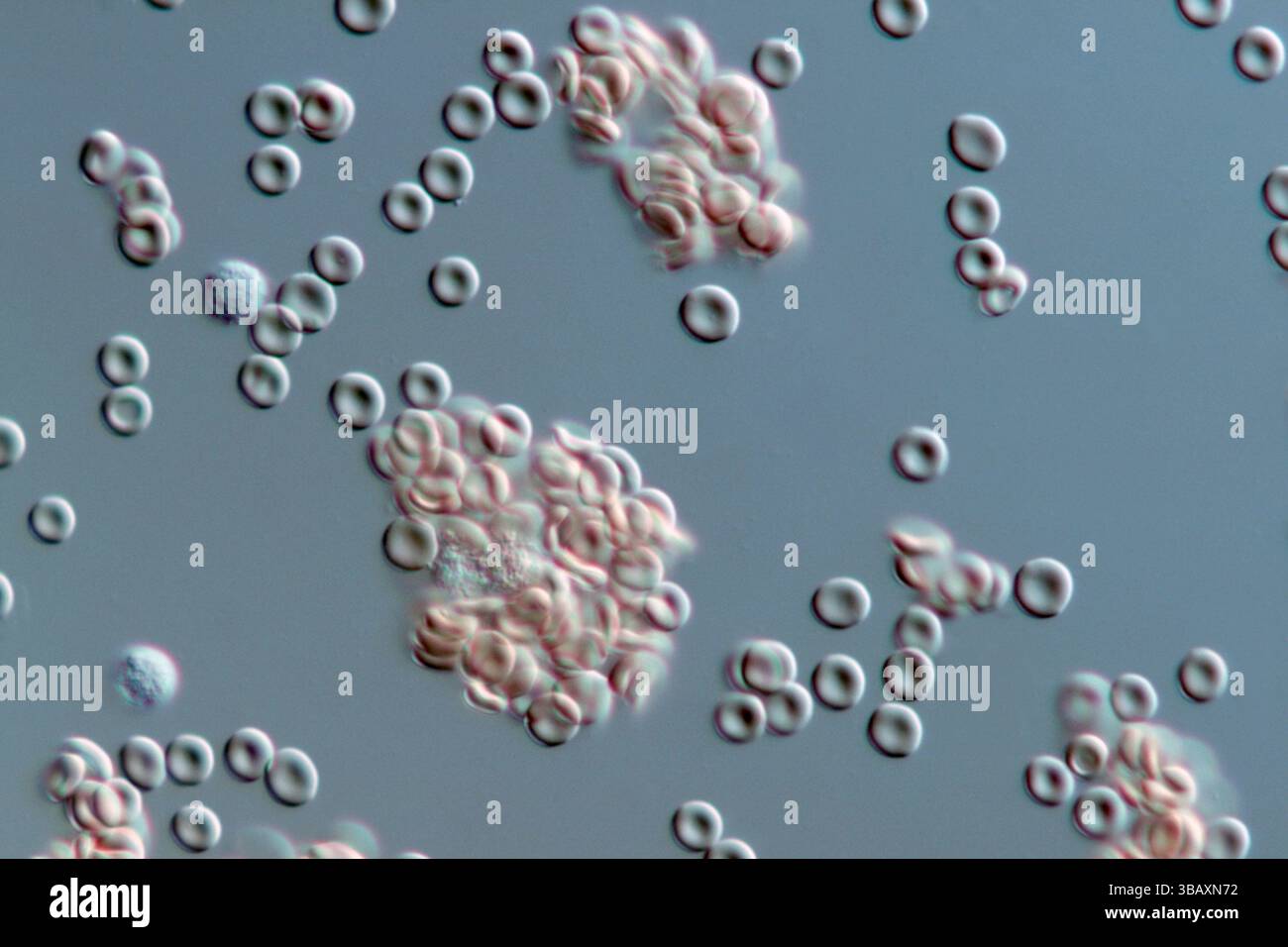 Red blood cell agglutination, light micrograph Stock Photo - Alamy