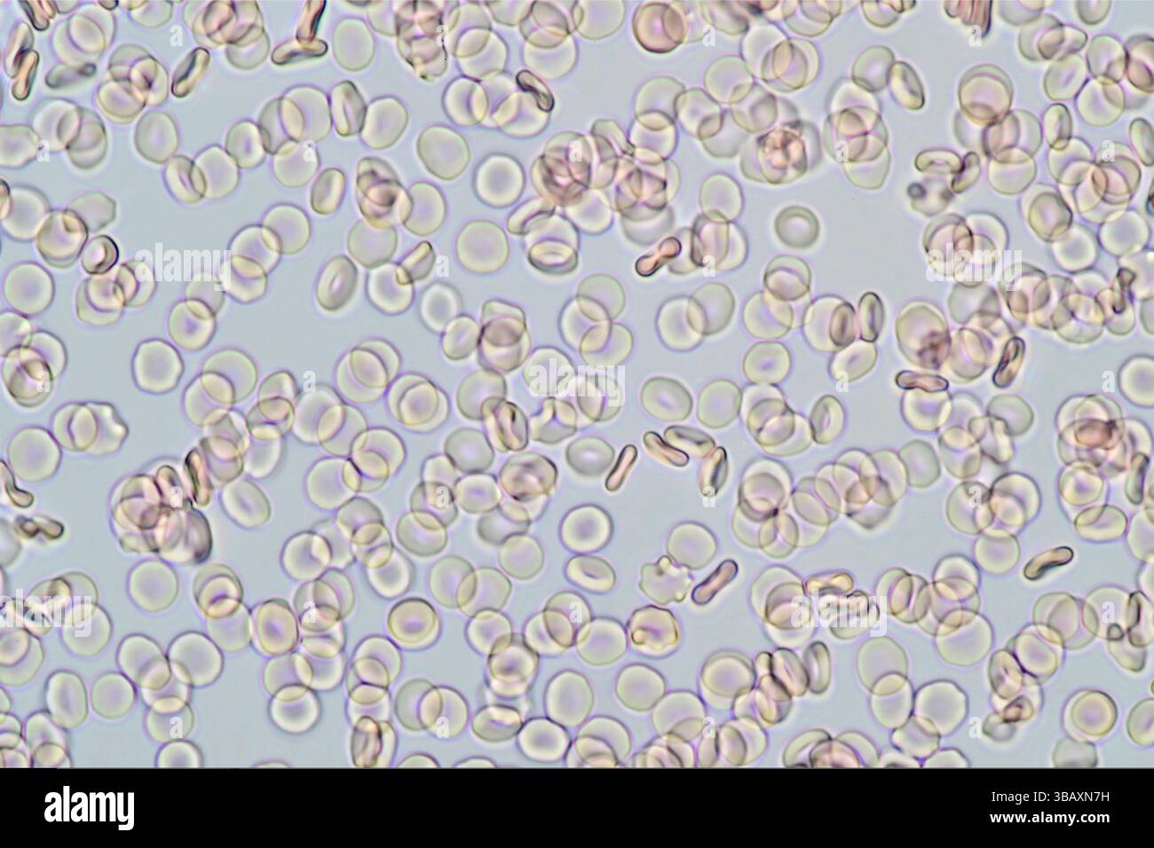 Human red blood cells, light micrograph Stock Photo - Alamy