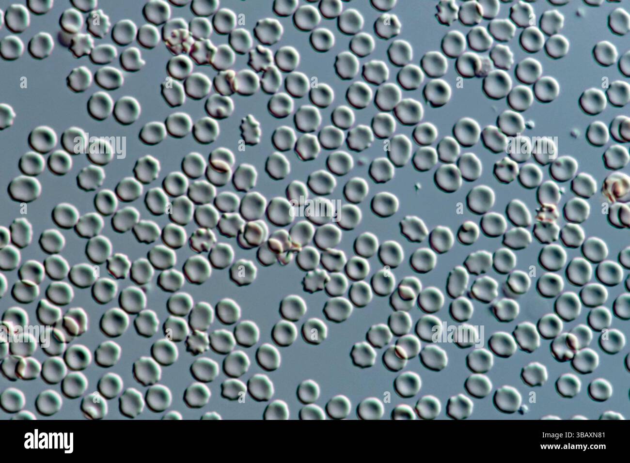 Type A red blood cells and anti-B serum, light micrograph Stock Photo ...