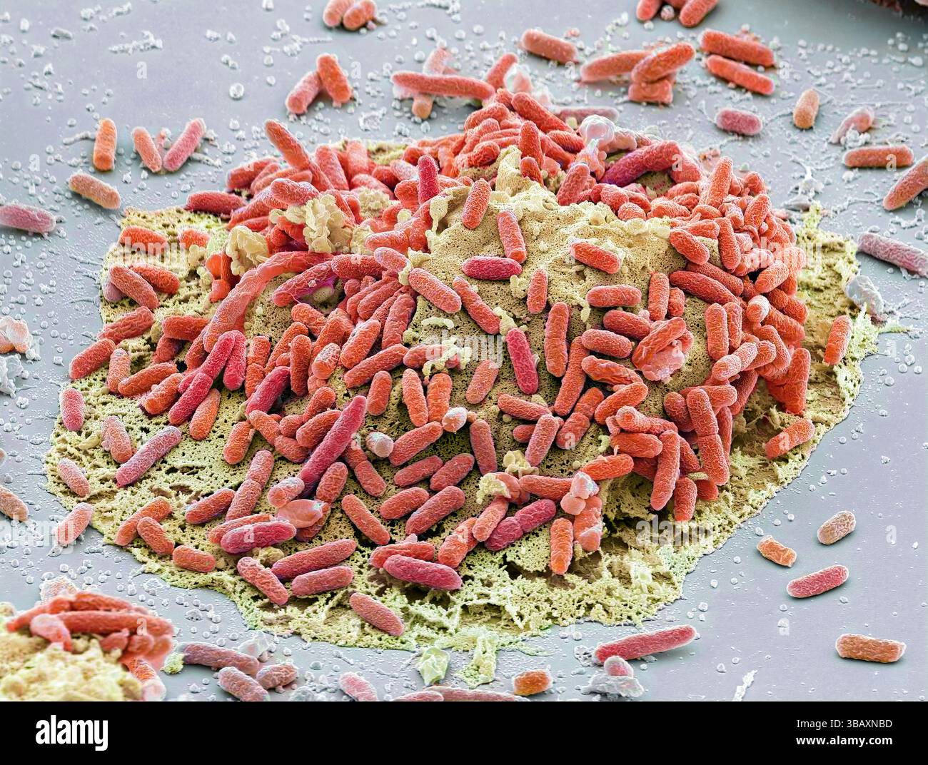 Bacterial cell death. Coloured scanning electron micrograph (SEM) of ...