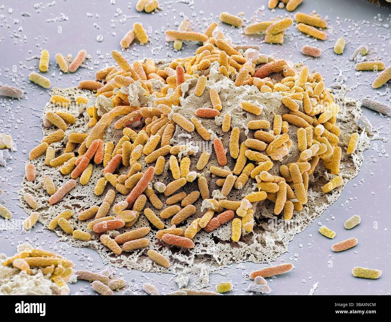 Bacterial cell death. Coloured scanning electron micrograph (SEM) of ...