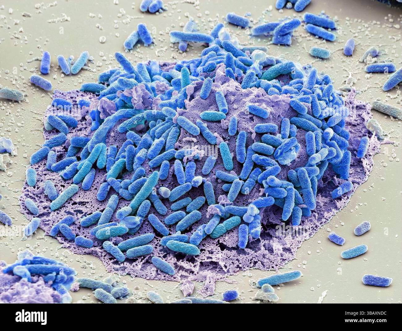 Bacterial cell death. Coloured scanning electron micrograph (SEM) of ...