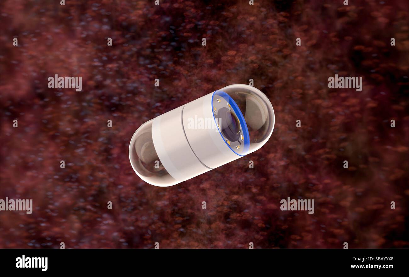 Capsule endoscope in intestine hi-res stock photography and images - Alamy