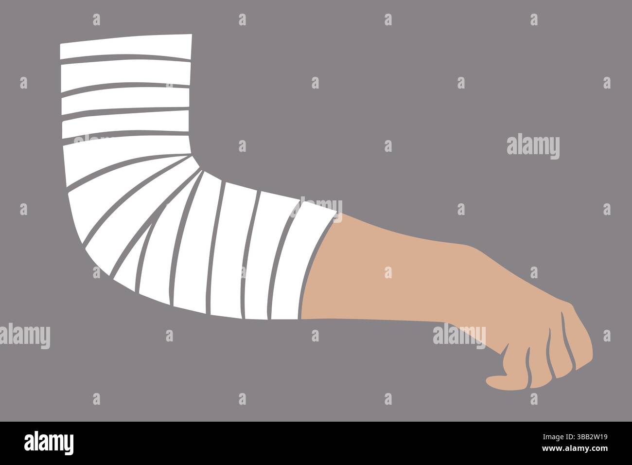 Vector isolated illustration of elbow bandaging. First aid for elbow ...