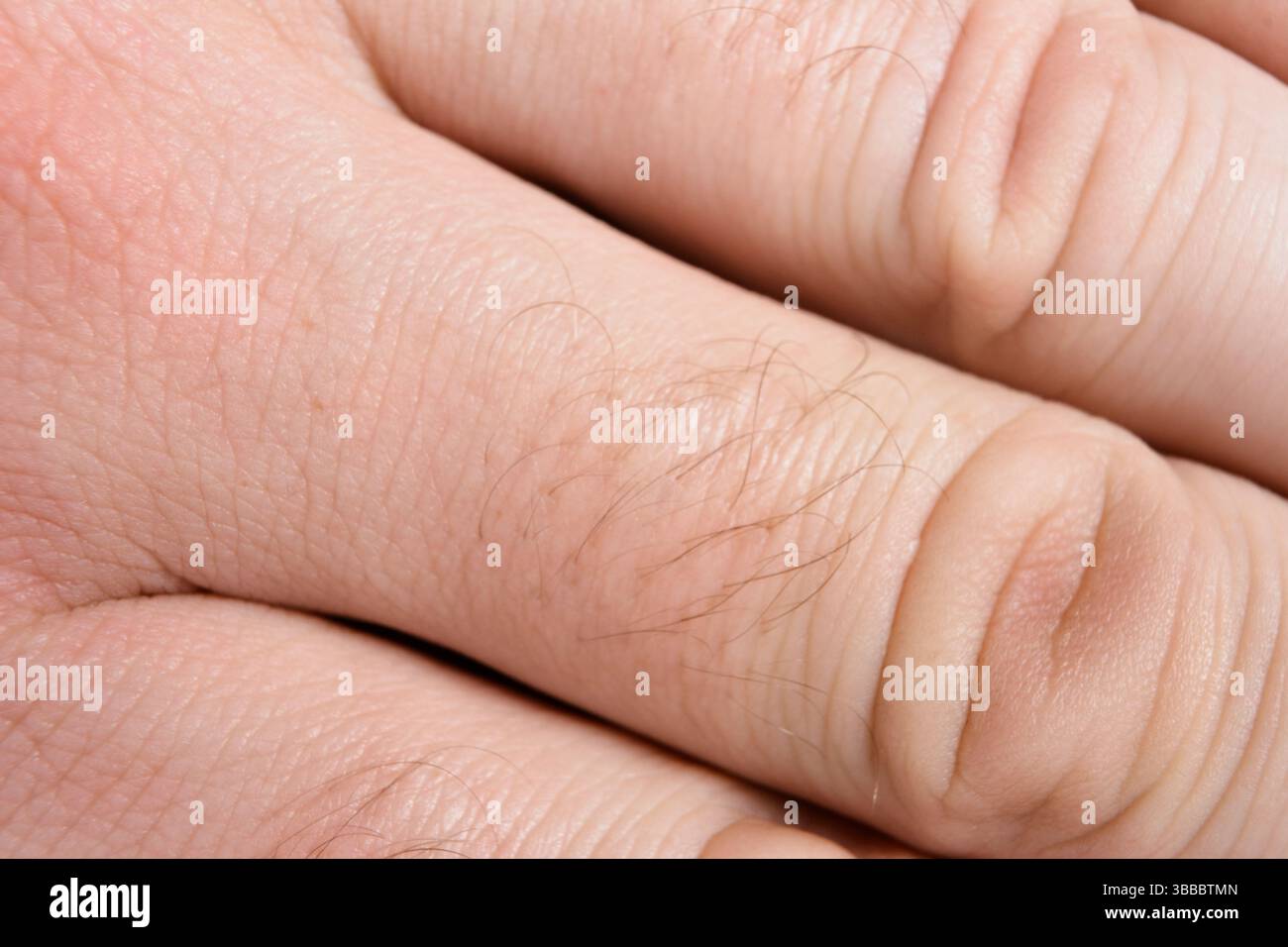 Detailed macro image highlighting the texture, pores, fine hairs, and ...