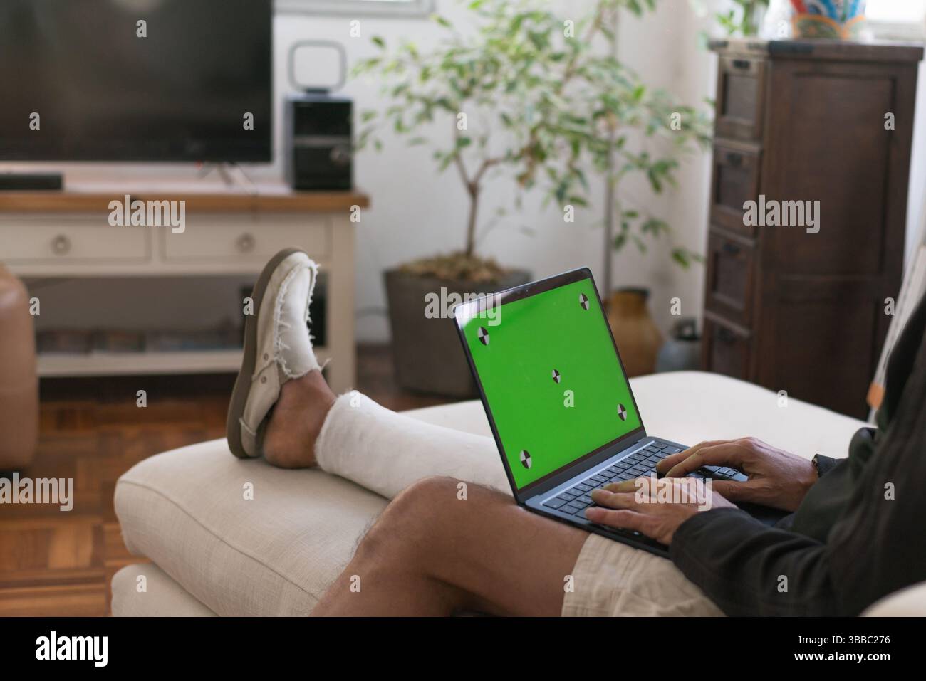 Man with broken leg relaxing on sofa and using laptop with green screen ...