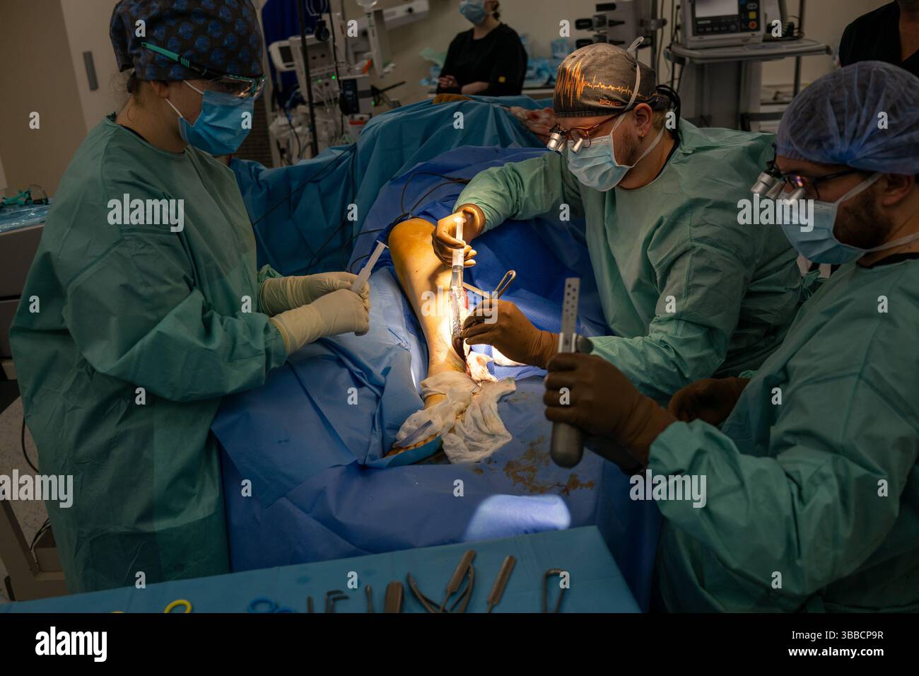 Surgeons transplant a section of bone from the leg of Ukrainian military veteran Oleksiy ...