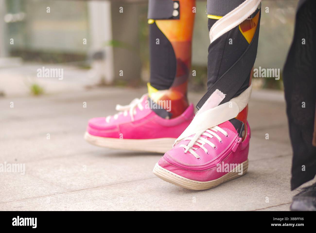 cerebral palsy child wearing leg brace for mobility Stock Photo - Alamy