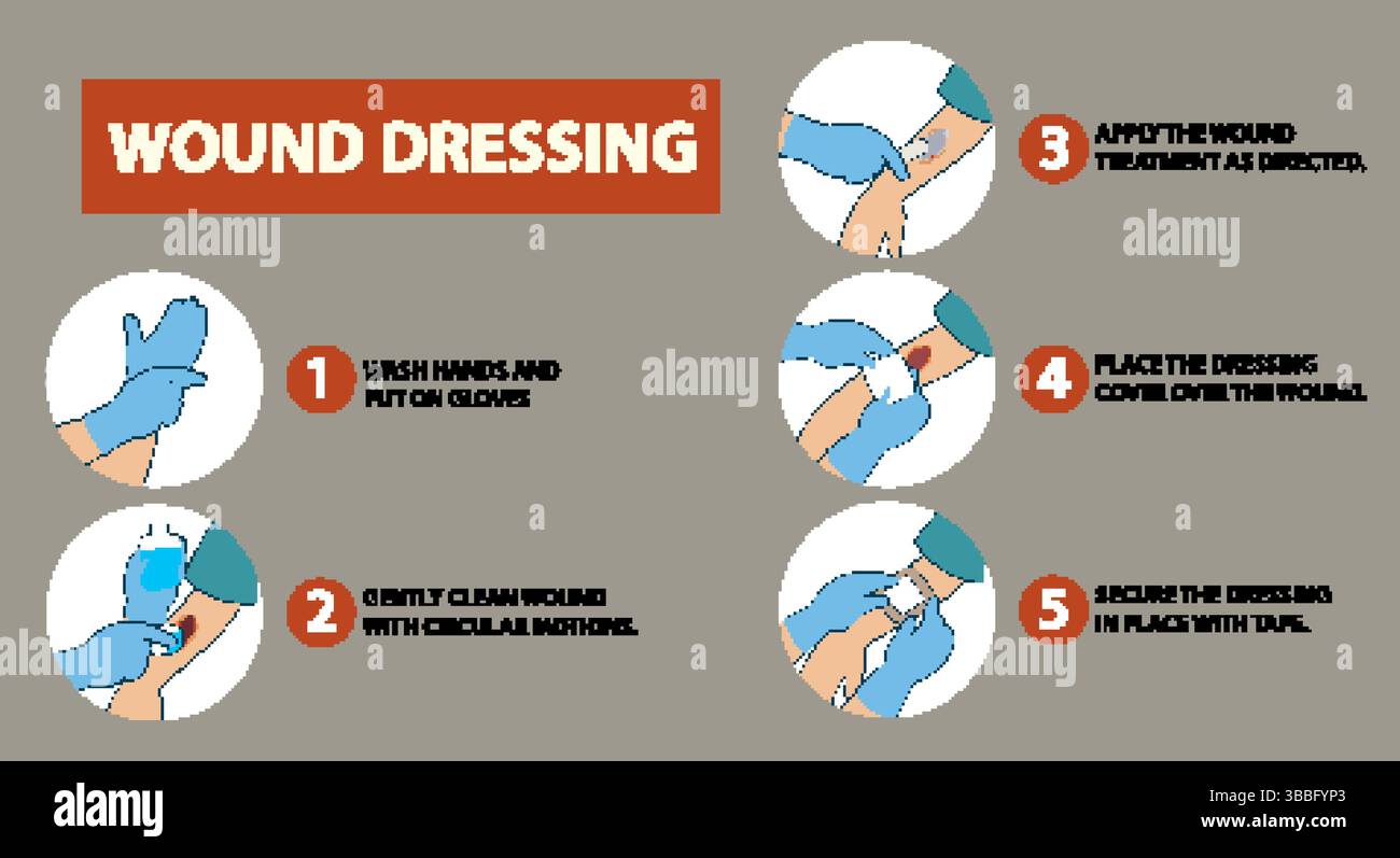 Illustration detailing the process of wound dressing with clear steps ...