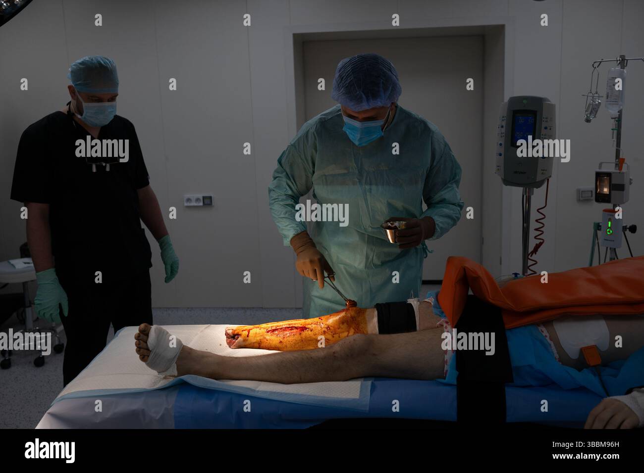 Surgeons amputate a segment of the leg of a Ukrainian military veteran ...