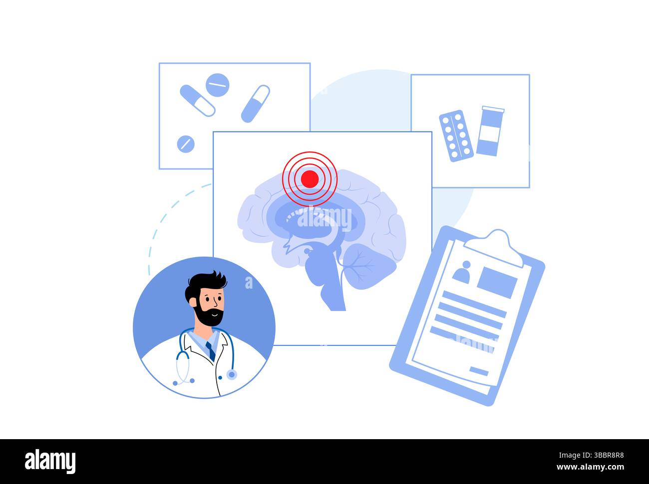 Illustration of brain cancer. A cancerous growth that develops in the ...
