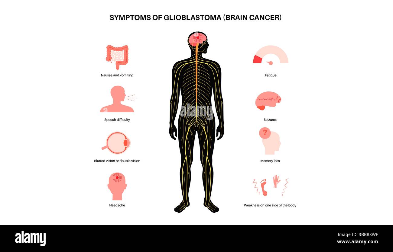 Illustration of primary brain tumour symptoms. These include headaches ...