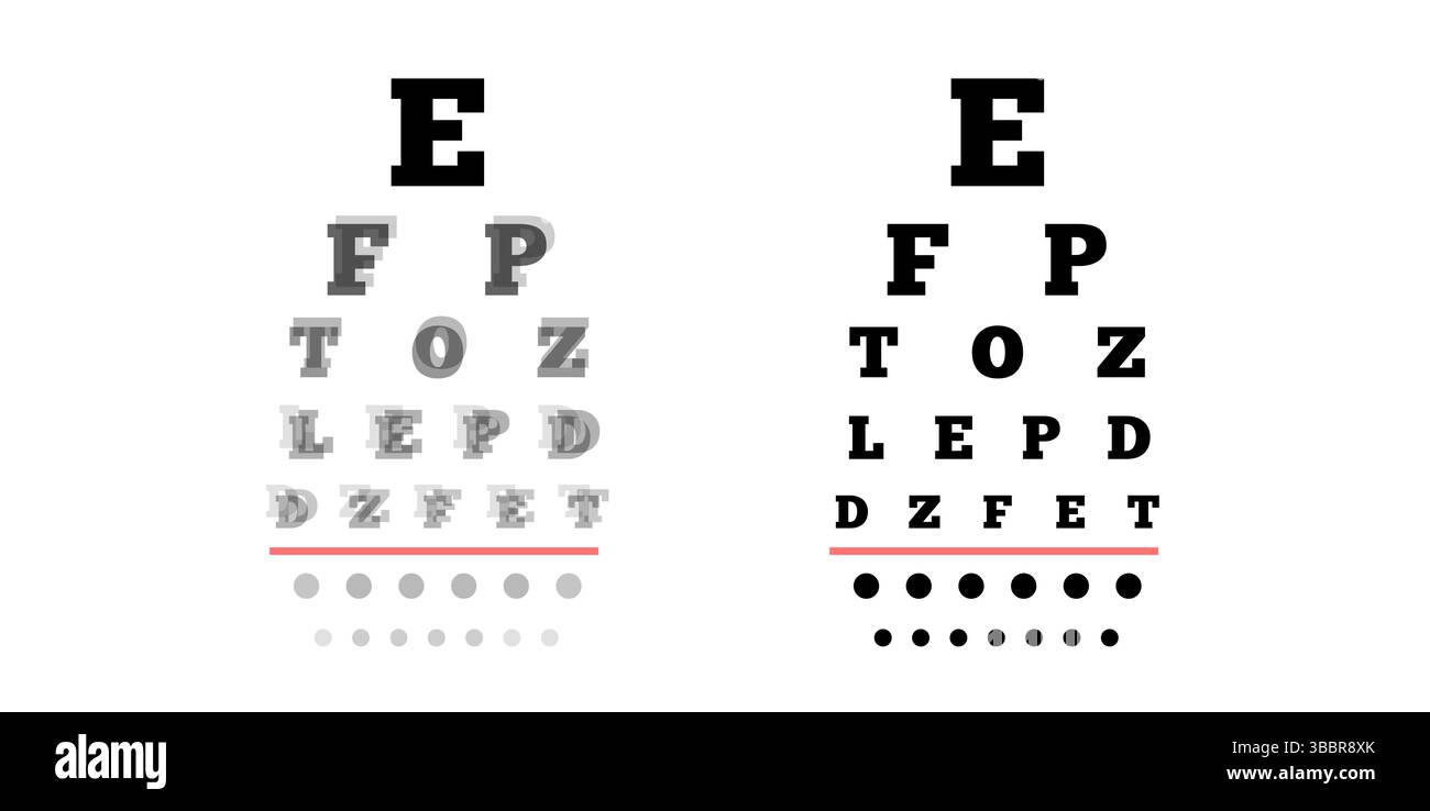 Illustration of an eye chart. An eye chart test assesses visual acuity ...