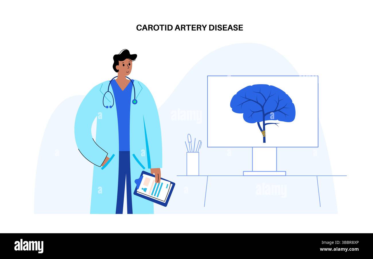 Illustration of carotid artery disease. This occurs when fatty deposits ...