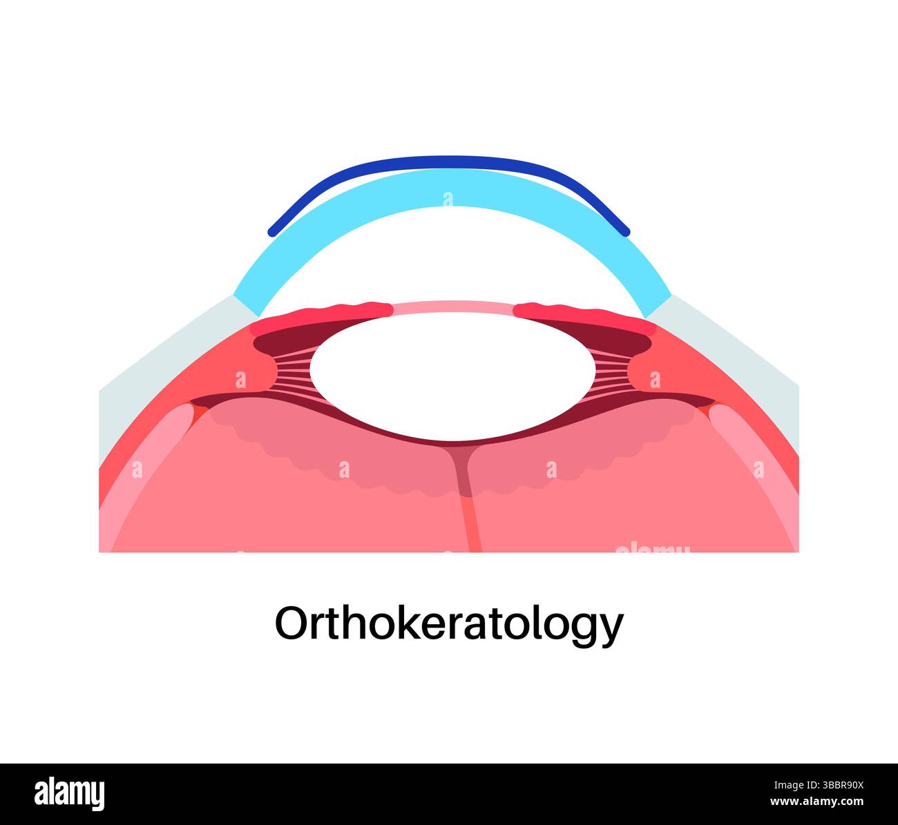 Corneal astigmatism Cut Out Stock Images & Pictures - Alamy