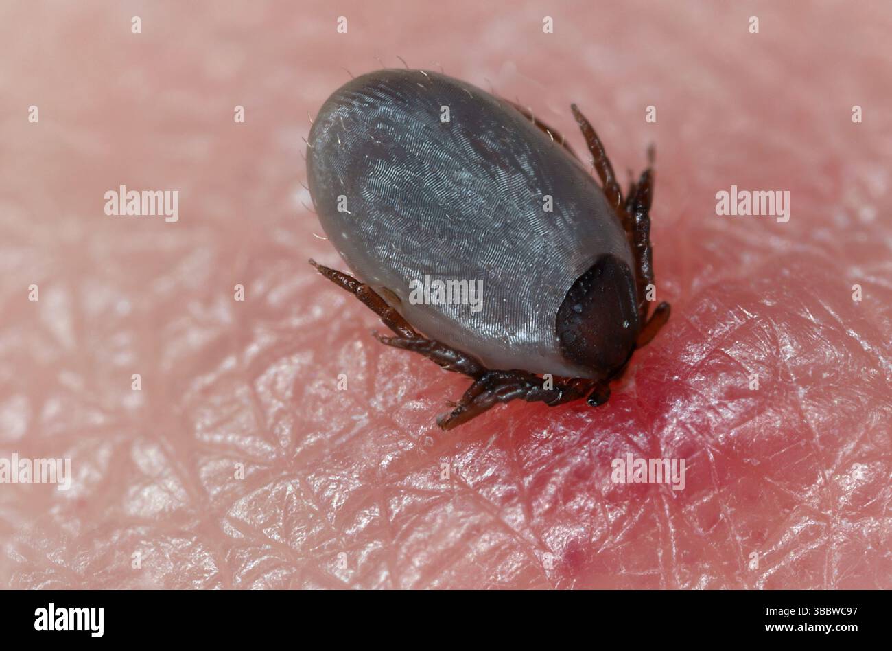 A tick that feeds on human skin. Blushing and redness. Details of the ...