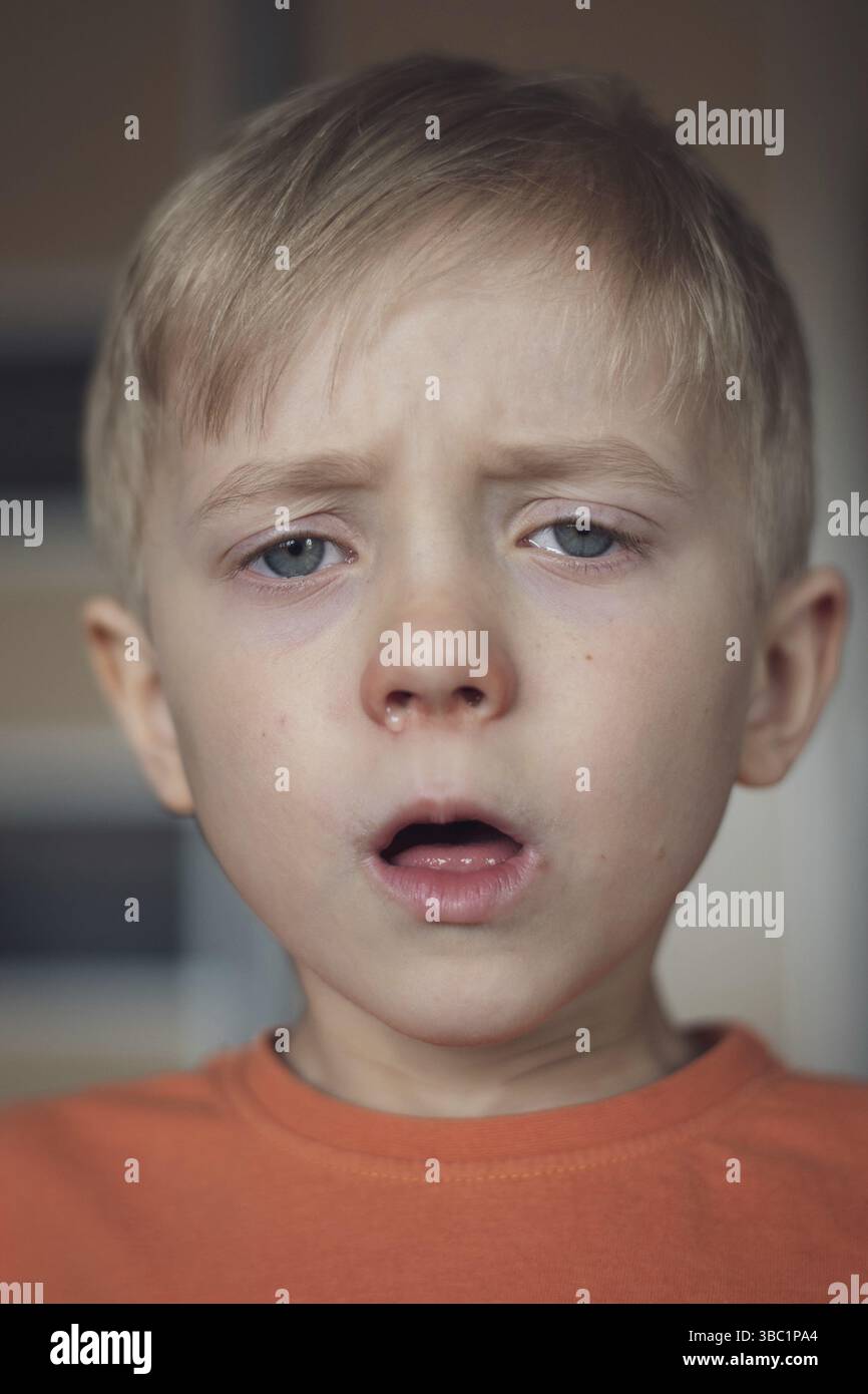 Five years old boy with allergy runny nose and glazed eyes Stock Photo ...