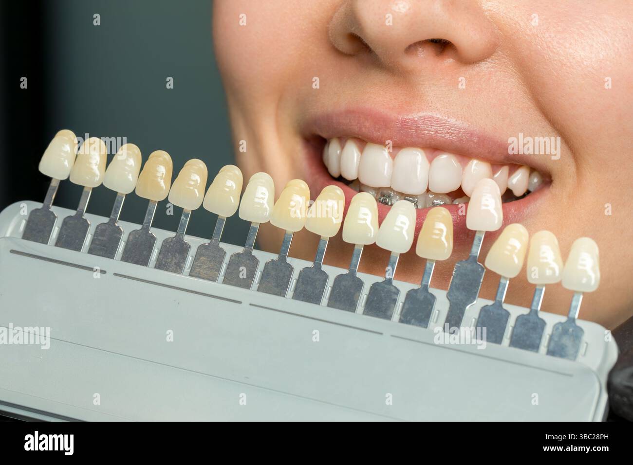 Dental teeth shade guide hi-res stock photography and images - Alamy