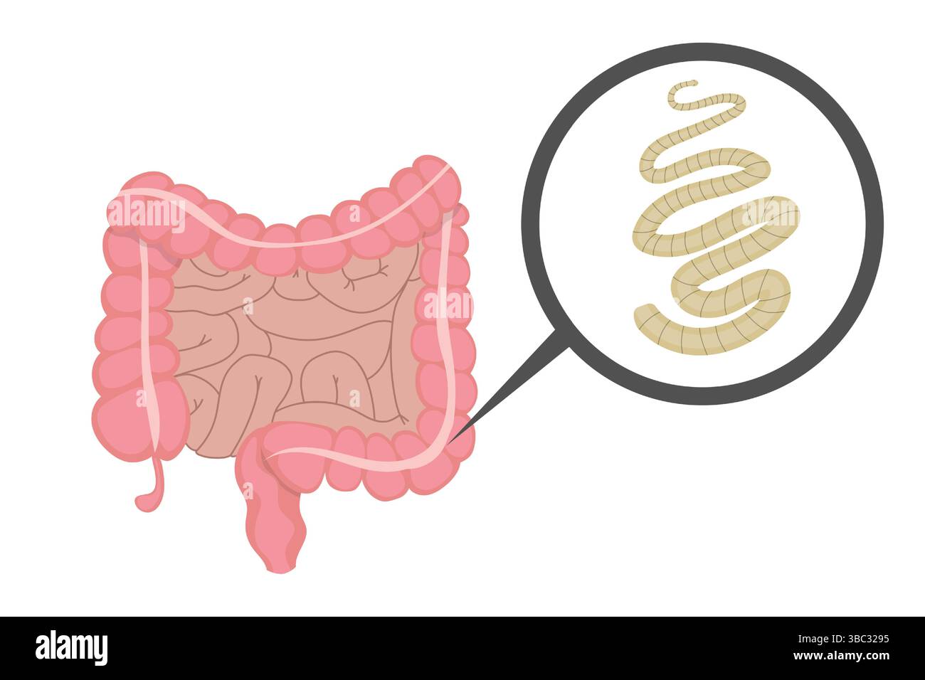 Magnifying glass revealing a tapeworm residing in the human intestine ...